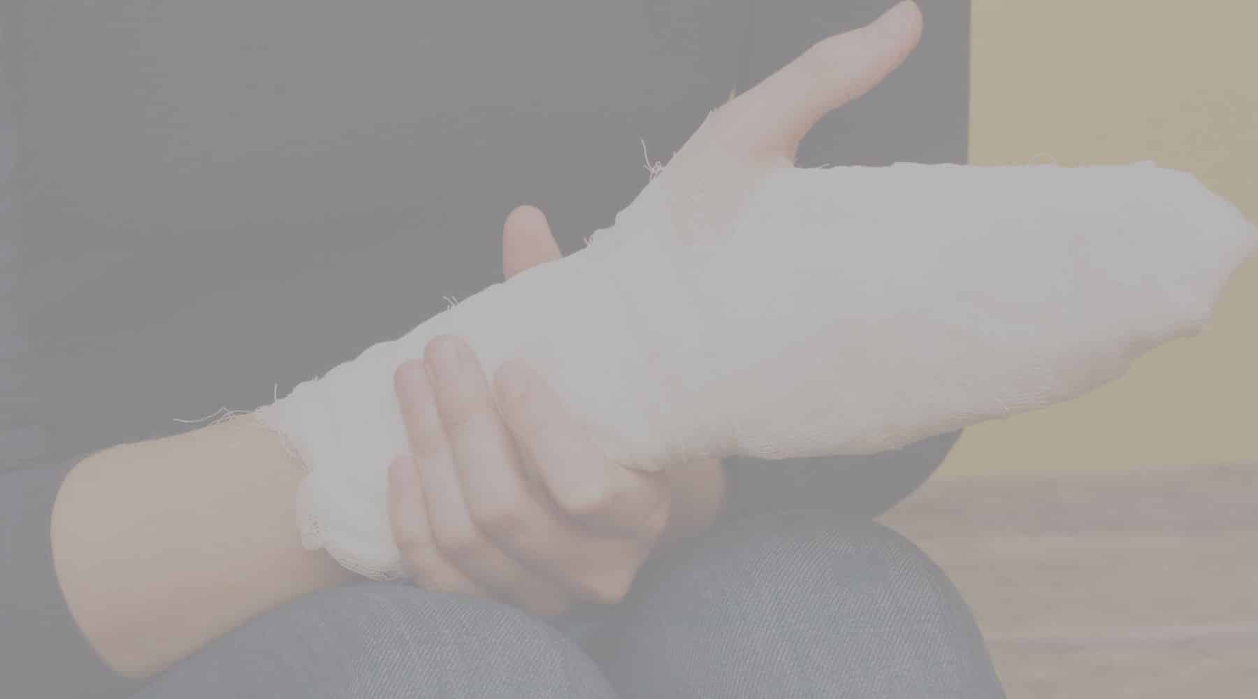 Las Vegas Burn Injury Attorney | The Cottle Firm